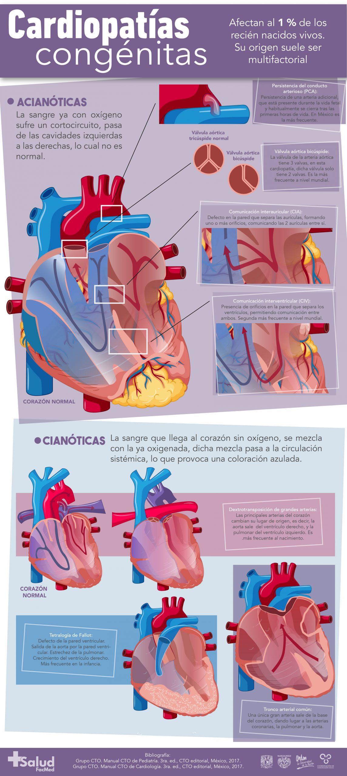 Cardiopatías Congénitas Salud Facmed