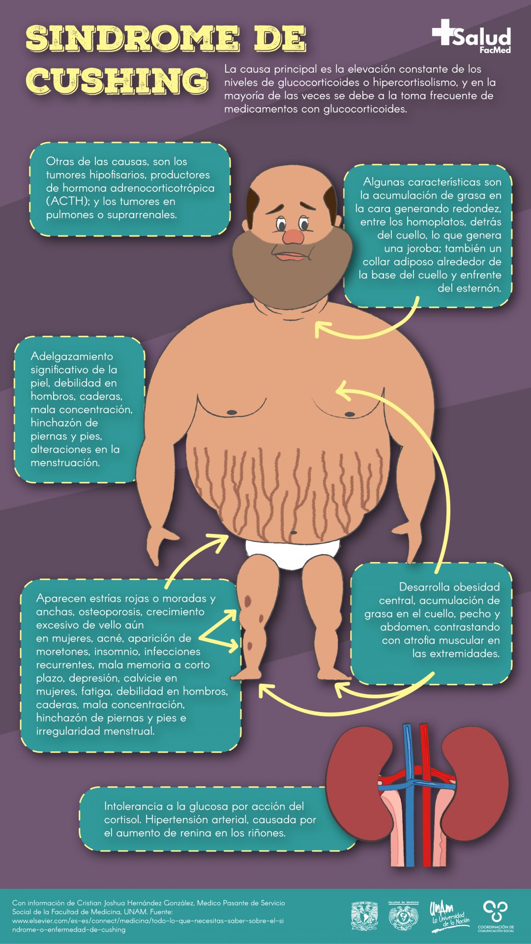 ¿qué Es El Síndrome De Cushing Salud Facmed